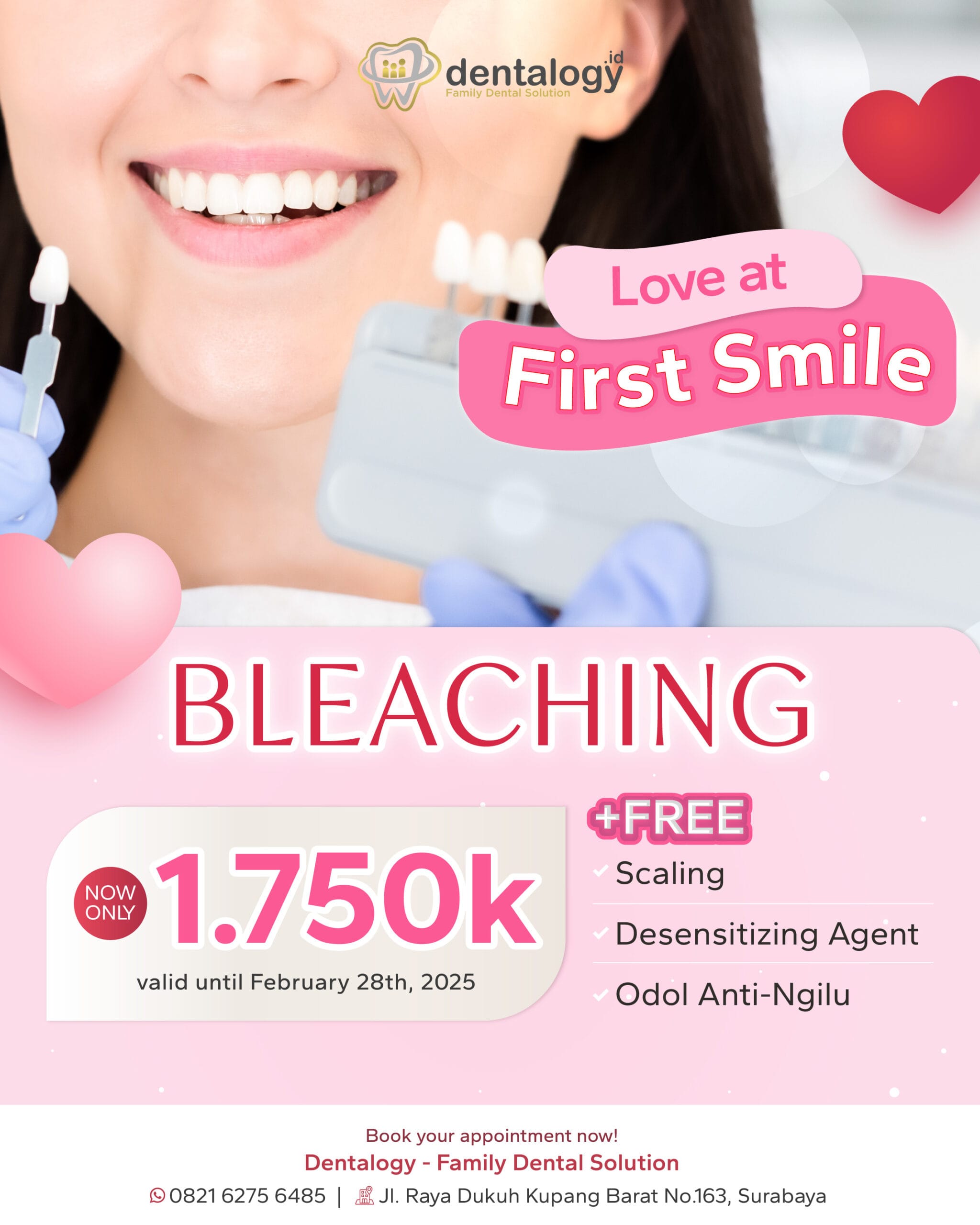 Love at First Smile: Bleaching - Dentalogy.id