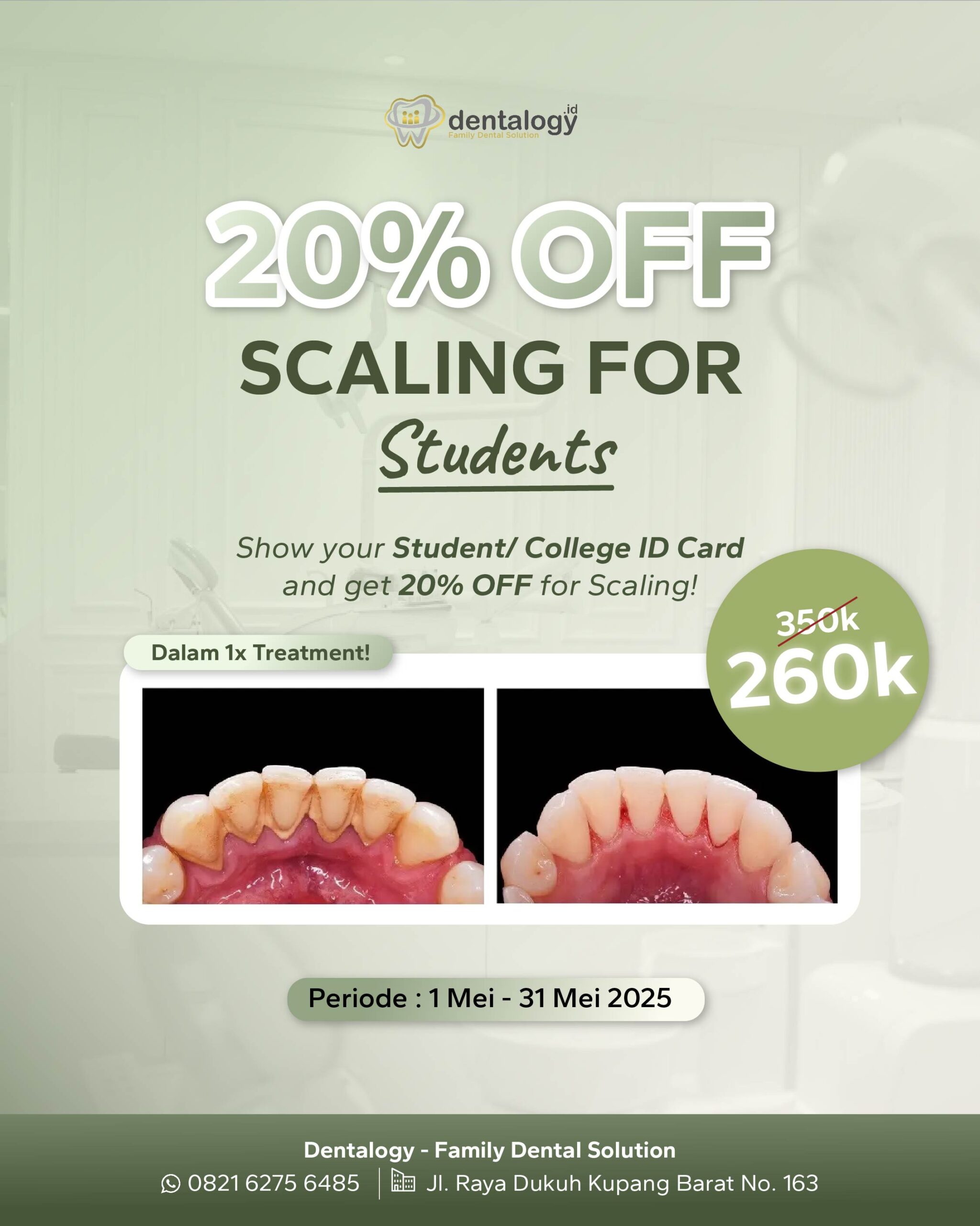 Scaling gigi sekarang, promo khusus buat kamu yang masih sekolah atau ...
